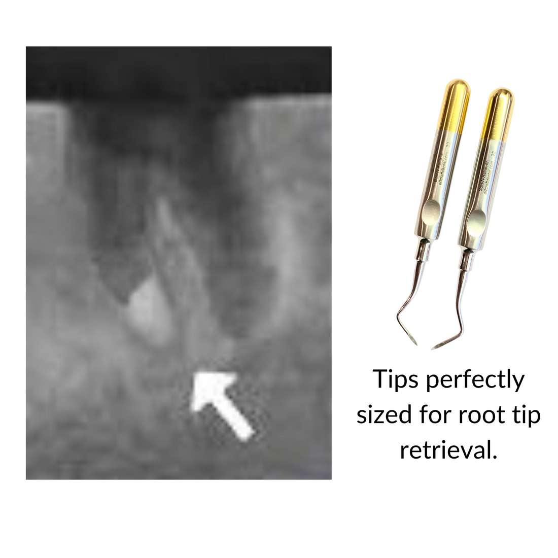 Golden Retrievers™ | Dental Root Elevator | Root Tip Elevator