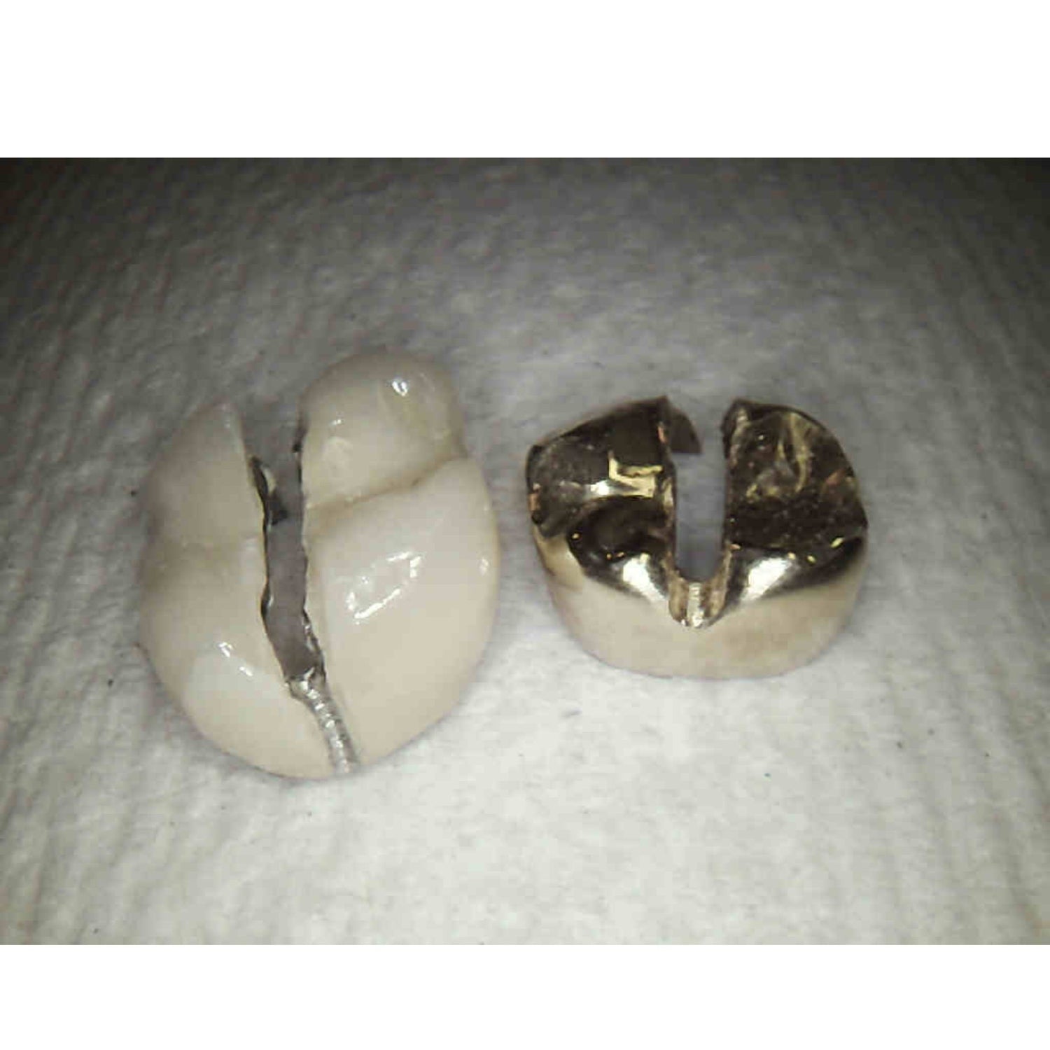 Introducing the Best Crown Remover for 60 Second Removals - Max Crown